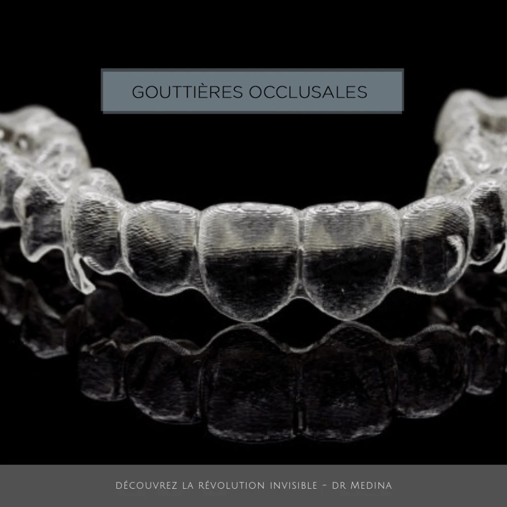 Occlusodontiste Paris | Traitements adaptés par le Dr Nadia MEDINA